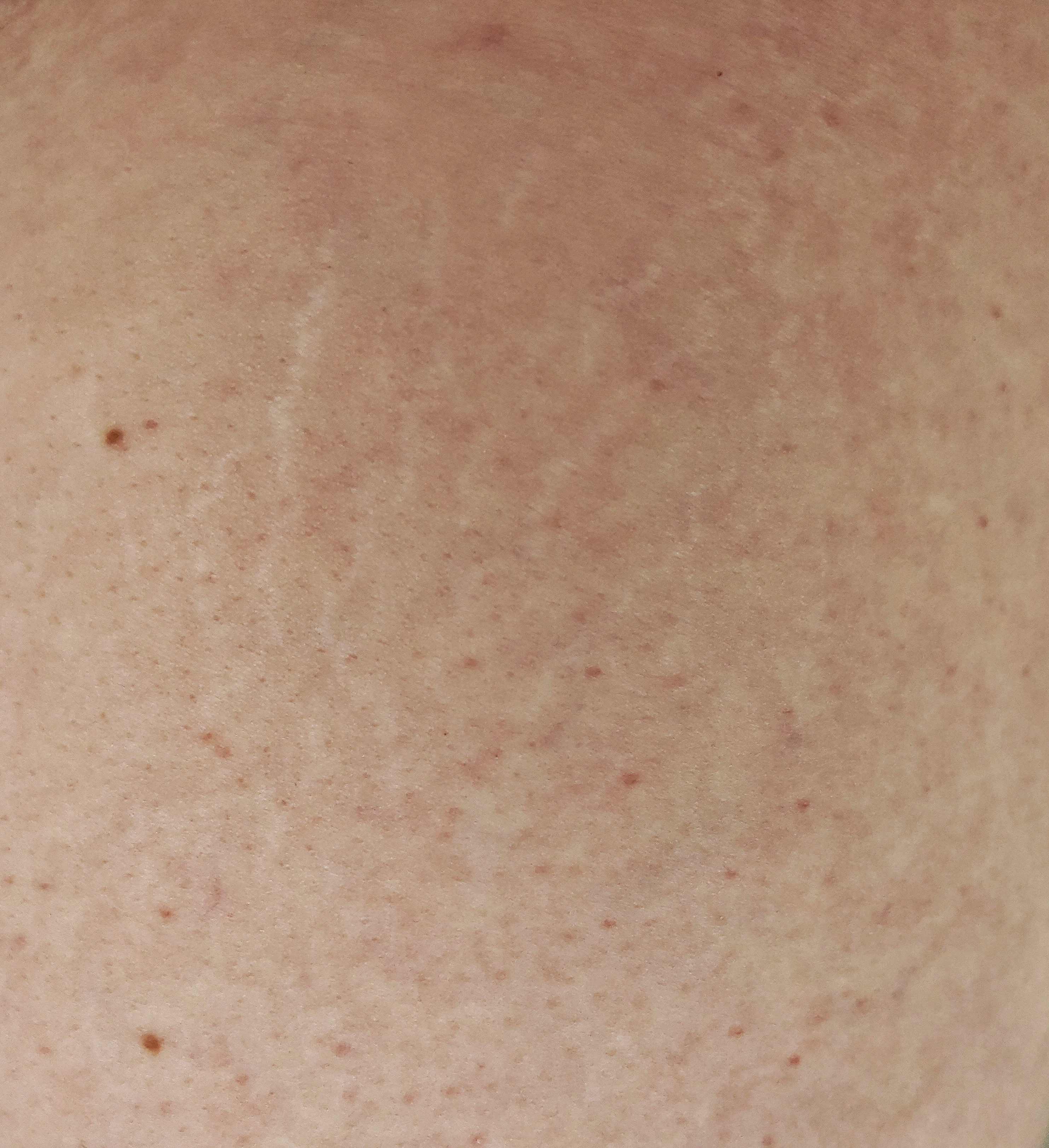 “Flaws”: Body Positivity Triptych – The Feminist Gadabout